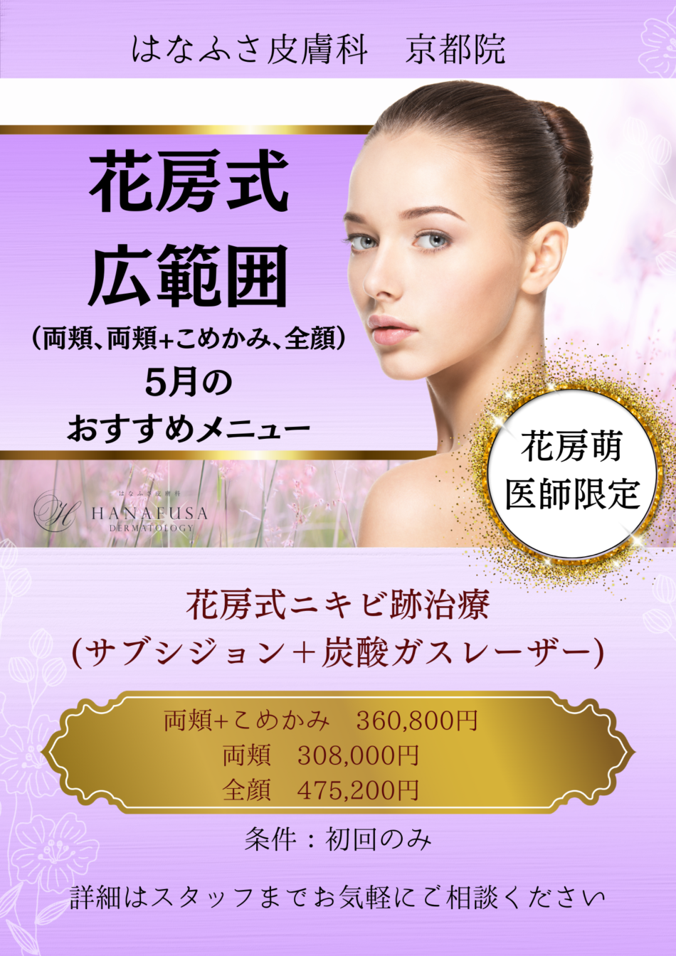【京都院5月おすすめメニュー】花房式ニキビ跡治療サブシジョン炭酸ガスレーザー お知らせ はなふさ皮膚科・美容皮膚科 関東・関西
